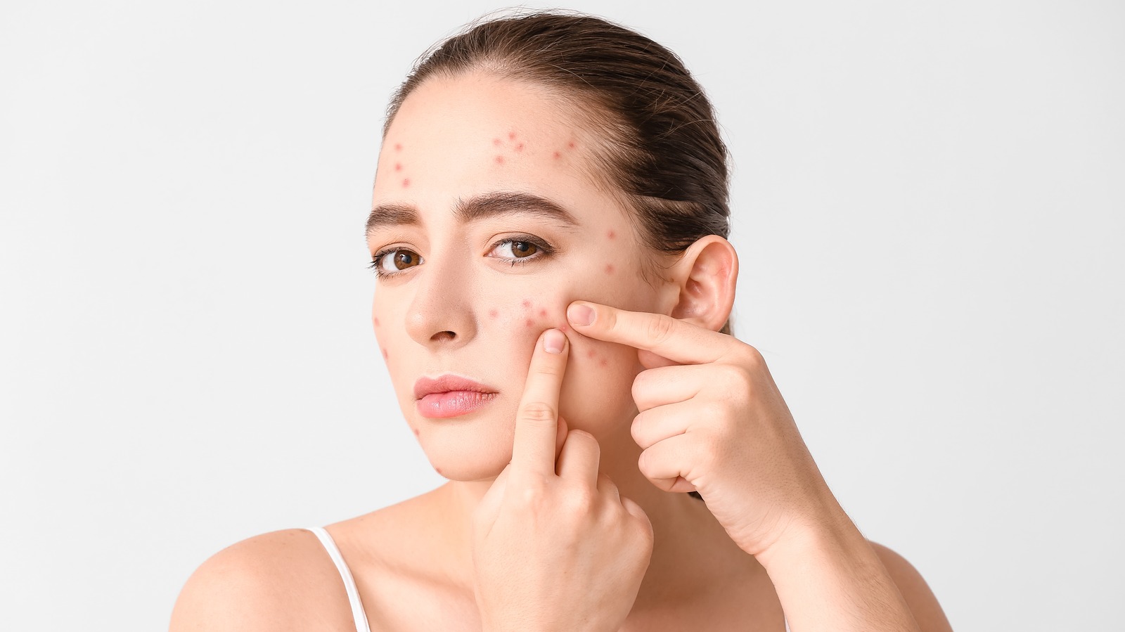 15 Acne Myths You Should Stop Buying Into