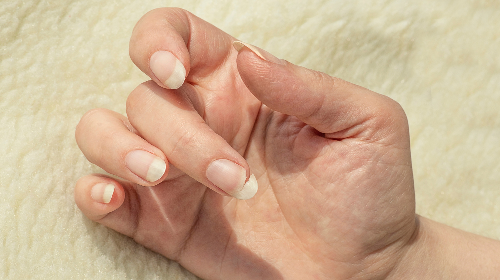 Reasons Your Nails Are Growing Unevenly