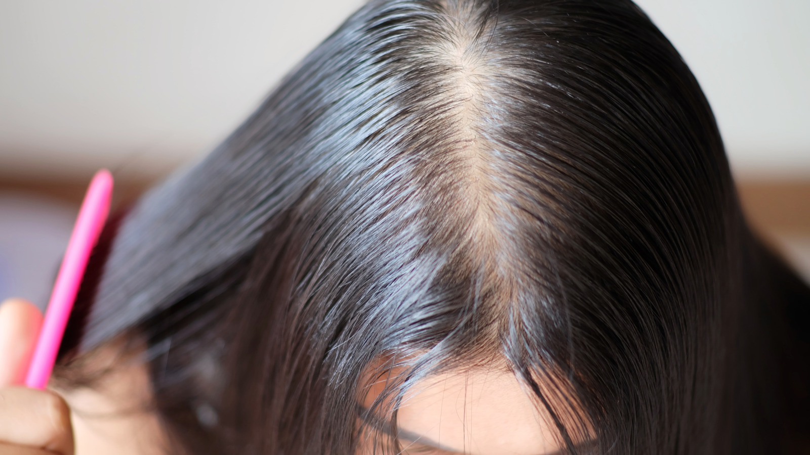 5 Styling Tips To Wear With Confidence If You Suffer From Hair Loss