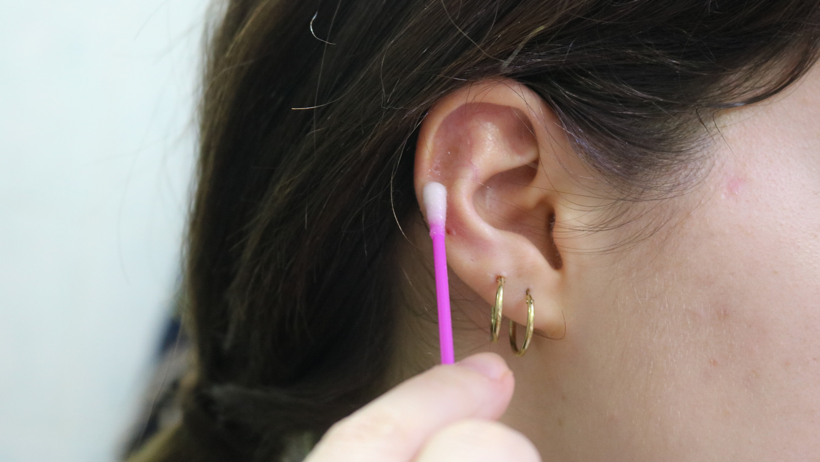 How A Keloid Differs From A Typical Piercing Bump