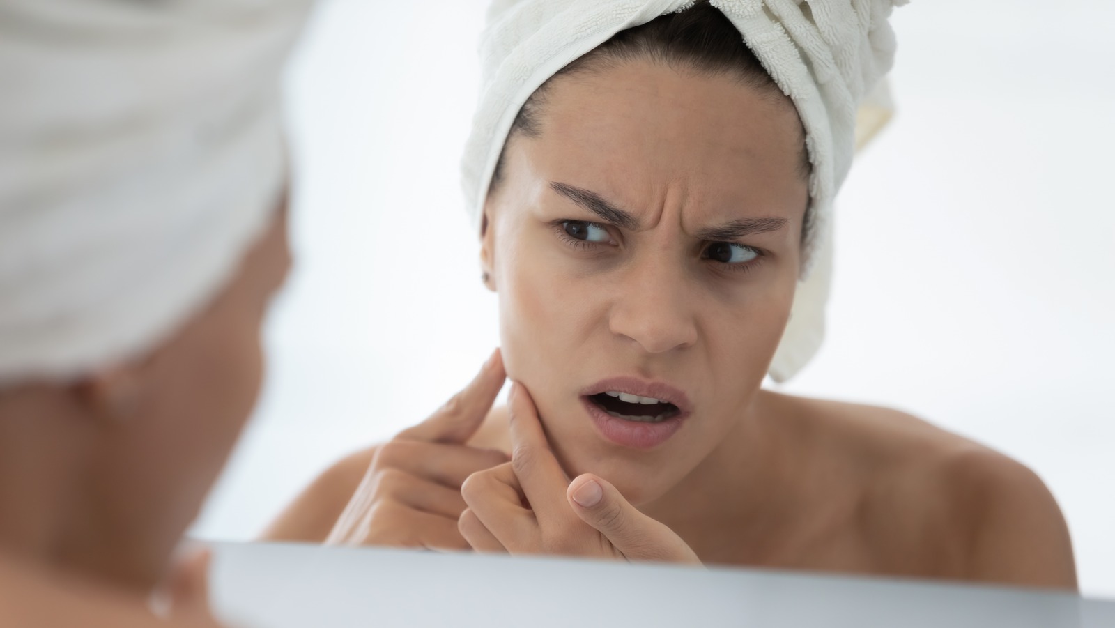 How To Identify & Treat Comedonal Acne, According To Our Dermatologist