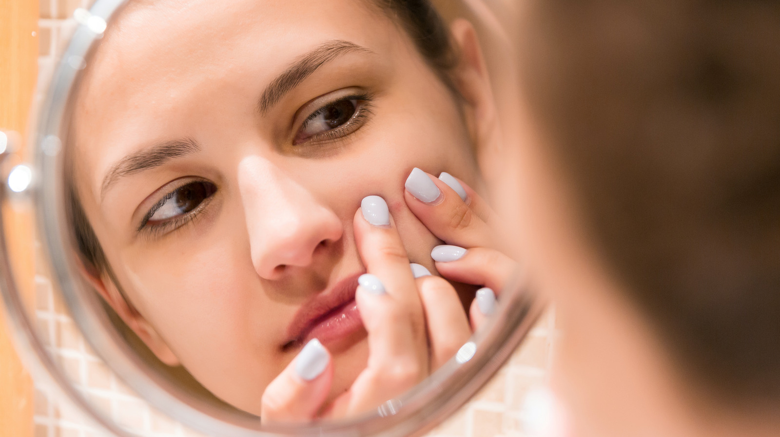 How To Tell If You Have Acne Excoriée