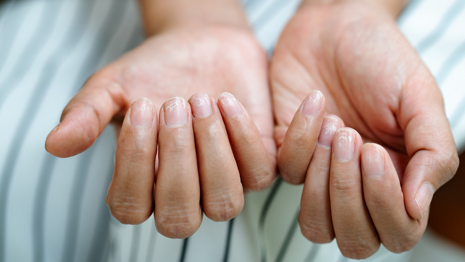 Our Esthetician's Best Tips To Improve Your Nail Strength