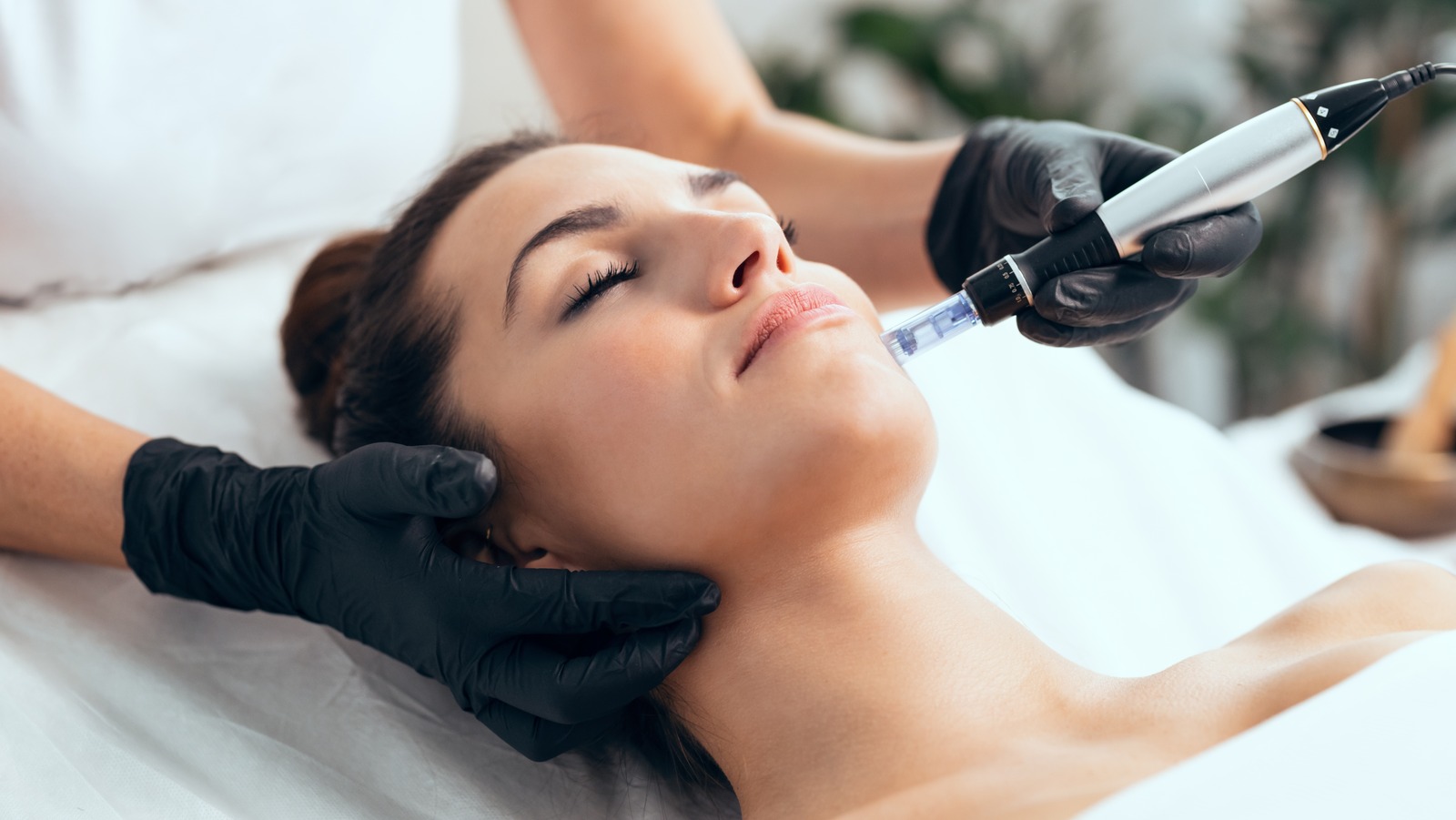 What To Expect After Microneedling What To Expect After Microneedling