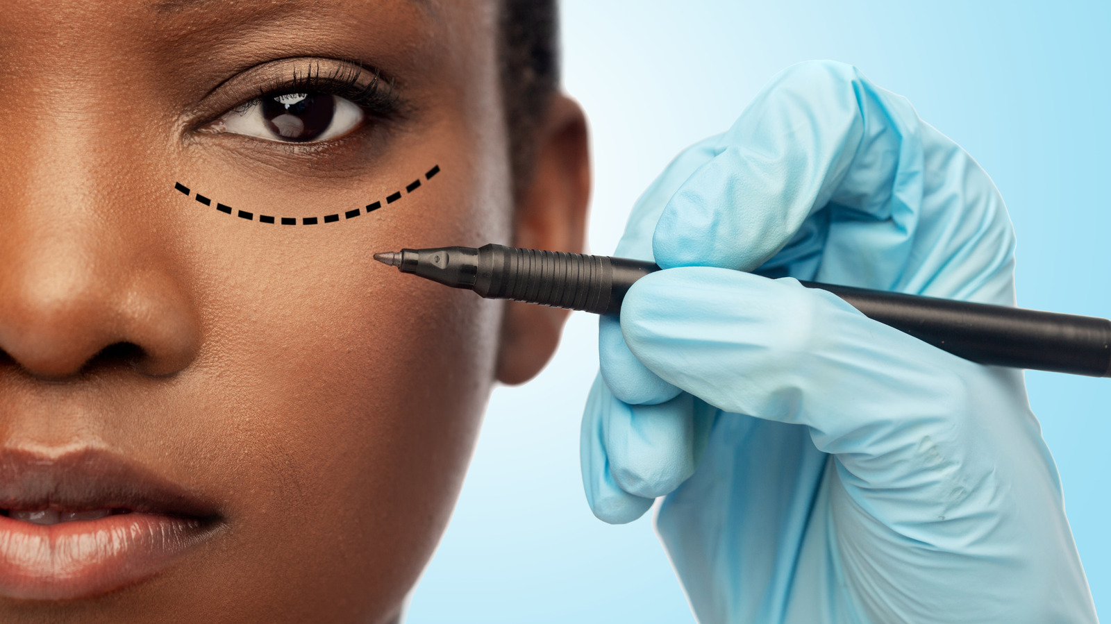 What To Know About Plastic Surgery's Newest Fad - The Ponytail Facelift