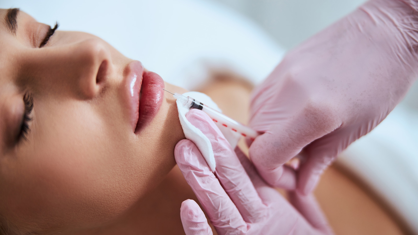 What To Know Before Getting Lip Tenting Filler, According To Our ...