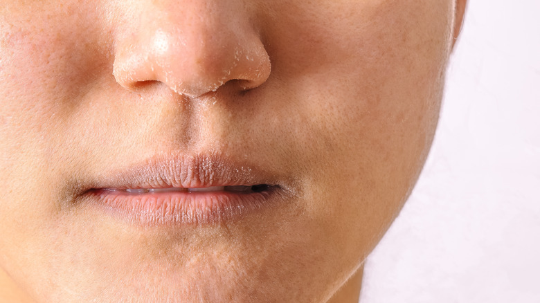 9 Causes For Dry Skin On Your Face & How To Treat Them